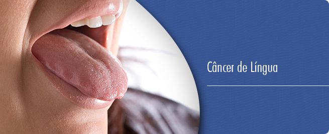 Blog Dr. Roberto Elias » Blog Archive » Câncer de Língua: conheça os ...